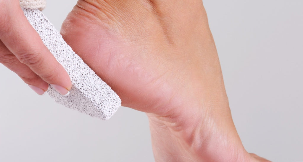 HIPERQUERATOSIS = CALLOSIDAD – Derma Express MX