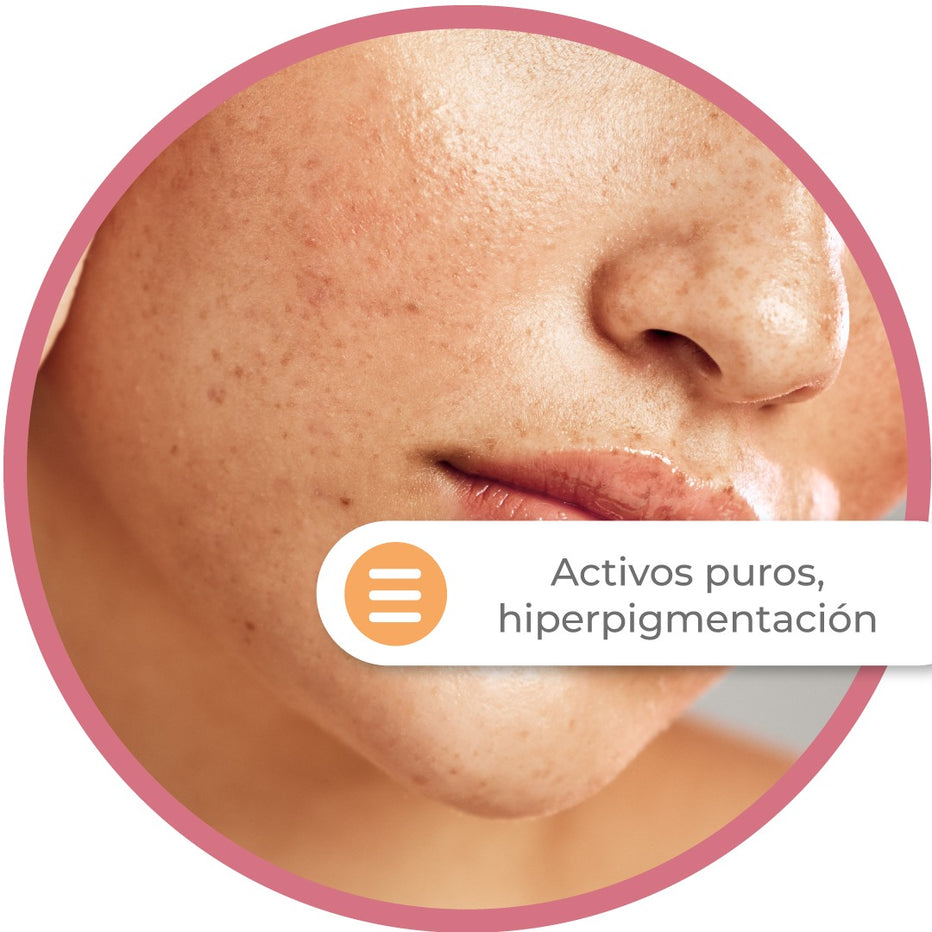 Etat pur – Derma Express MX