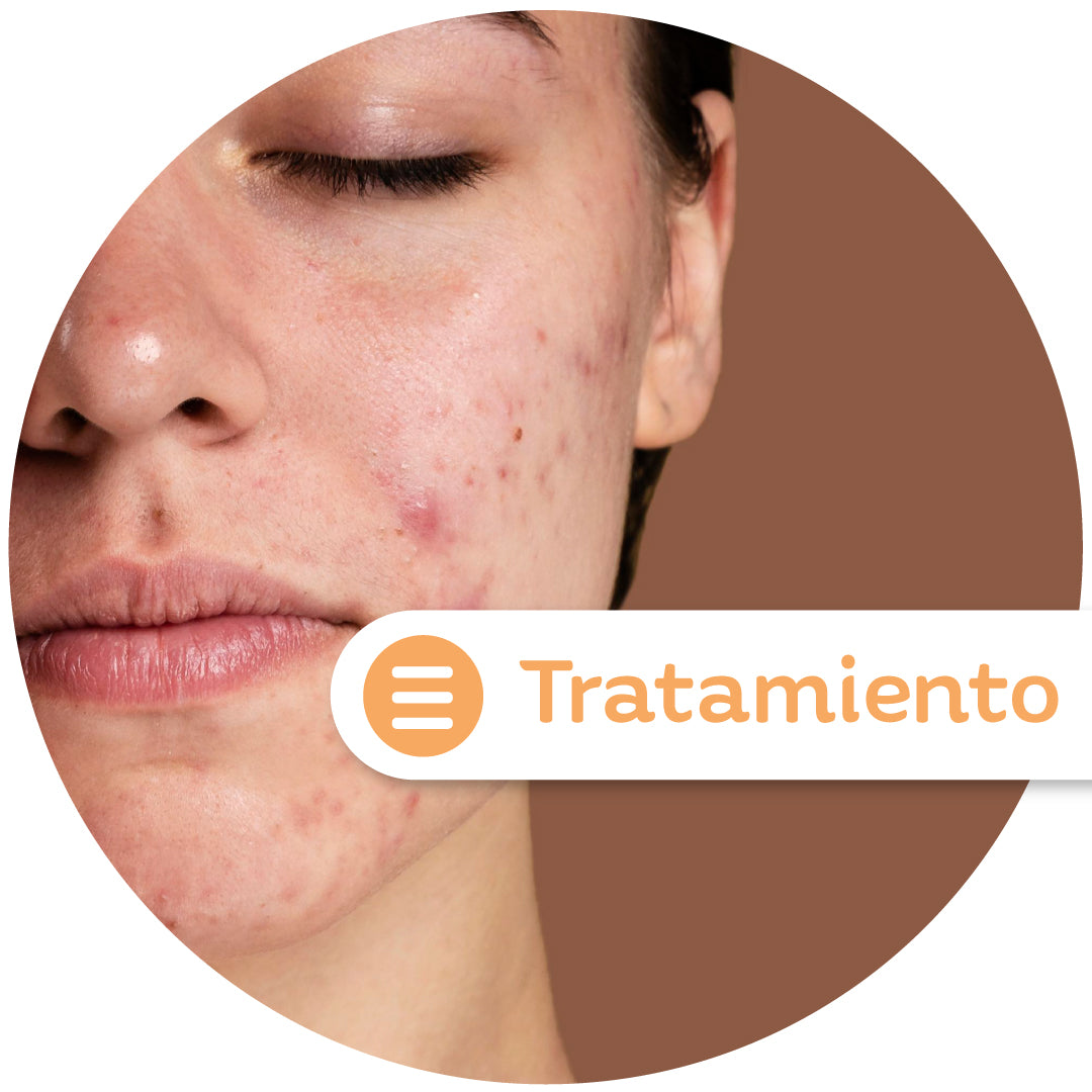 Derma Express • Todo para tu Piel • Farmacia online • Dermatología ...